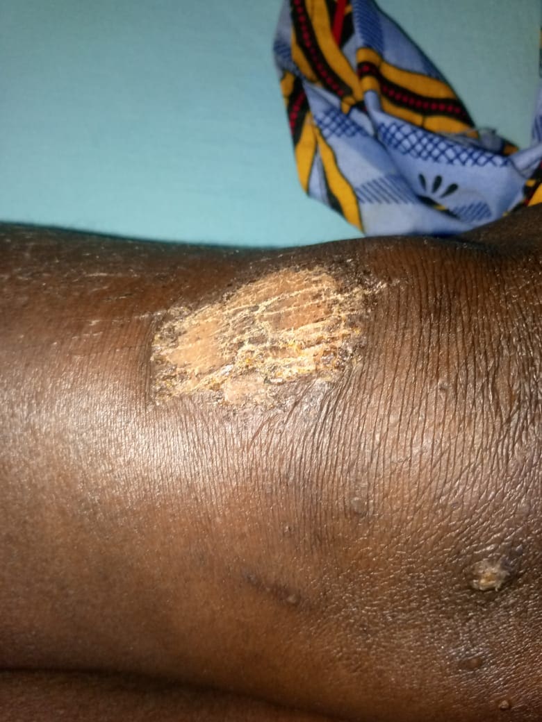 British Parliament Demands Answers as Fulani Militia Attacks Escalate ...